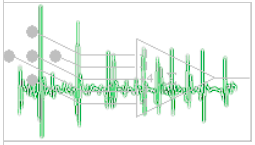 ELAPS - Institut de Myologie
