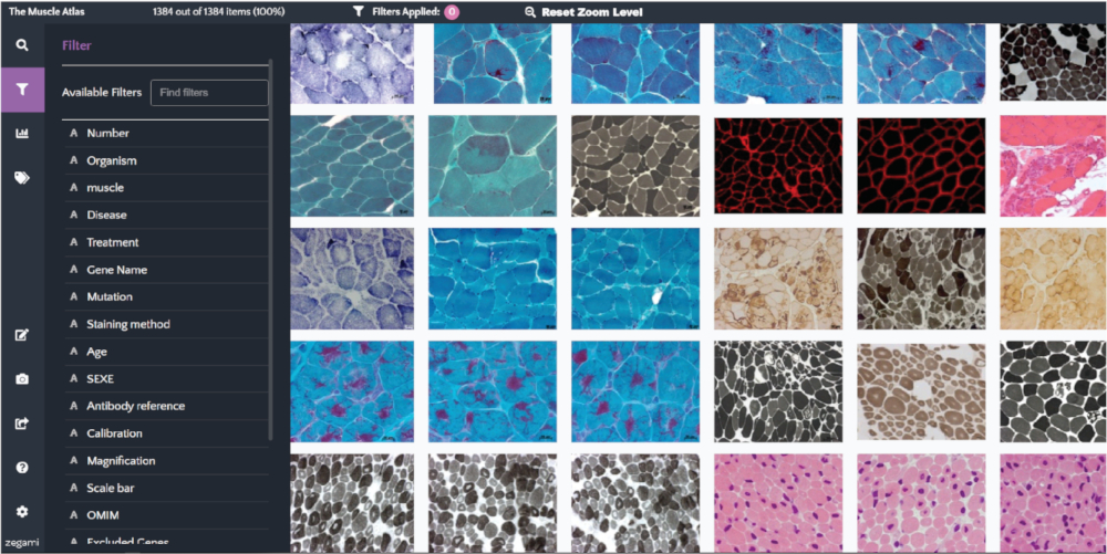 Muscle Atlas Banner-2 - Institut de Myologie
