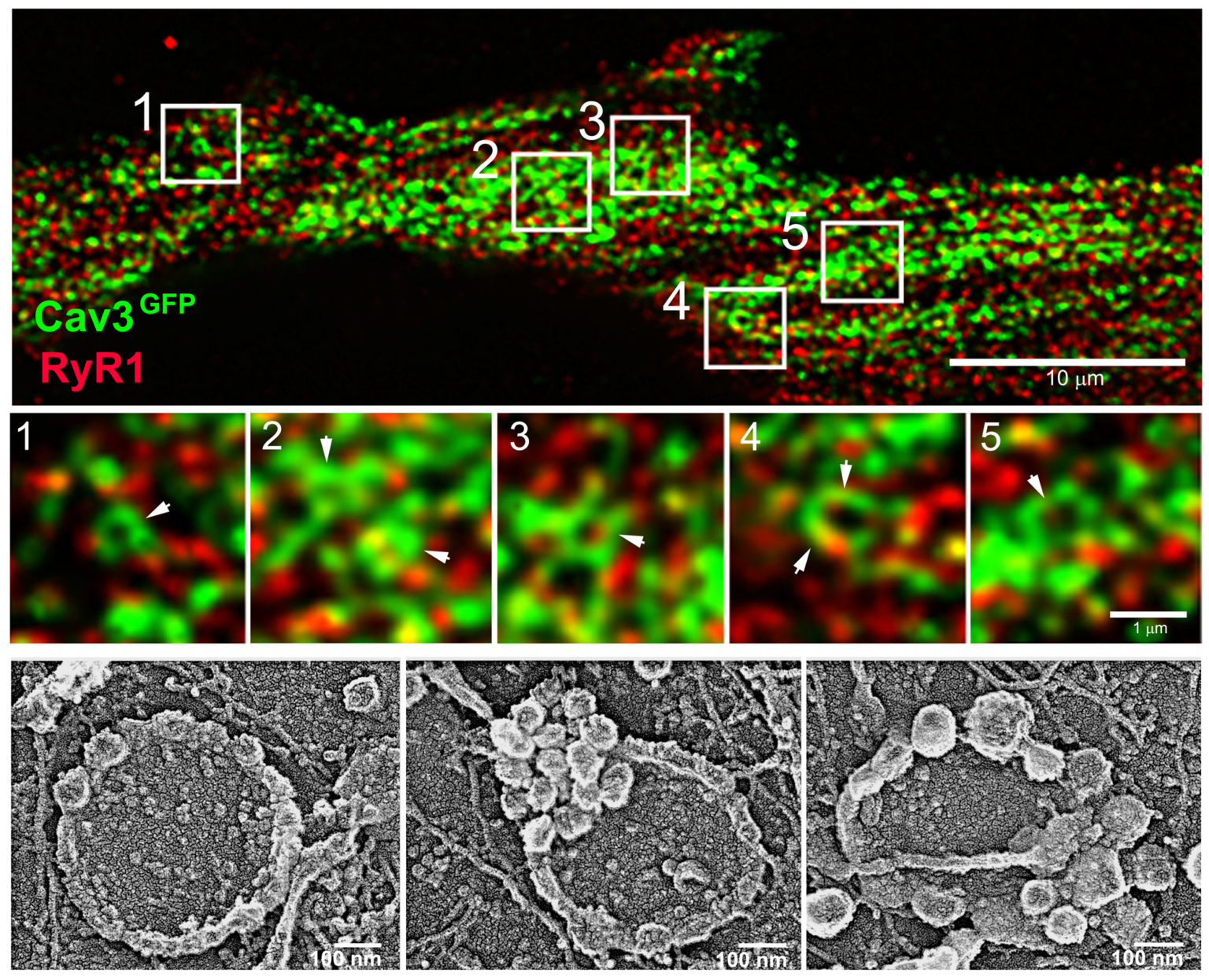 Role of caveolae in T-tubule formation in the muscle cell - Interview ...