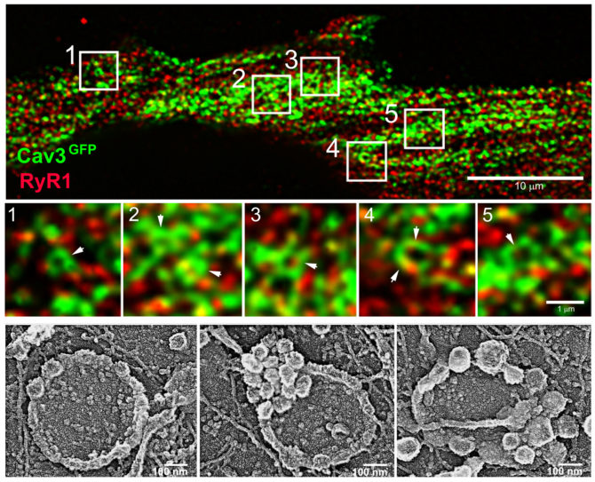 Rôle des cavéoles dans la formation des tubules T dans la cellule ...
