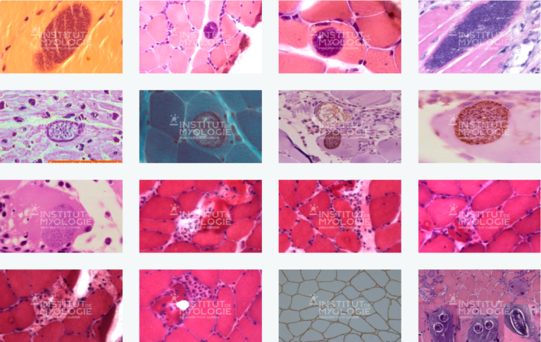 Muscle Atlas - Institut de Myologie