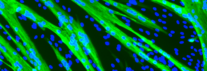 MyoLine - Institut de Myologie