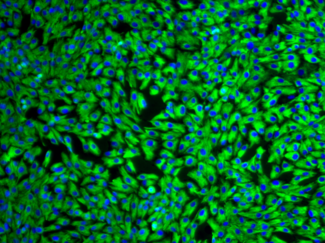 MyoLine - Institut de Myologie