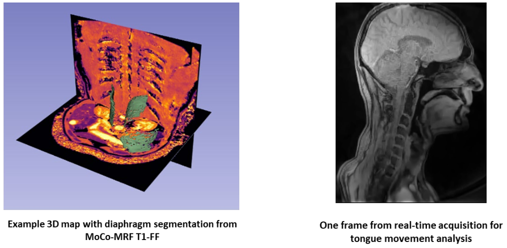 The RMN lab offers a PhD opportunity on the development of real-time ...